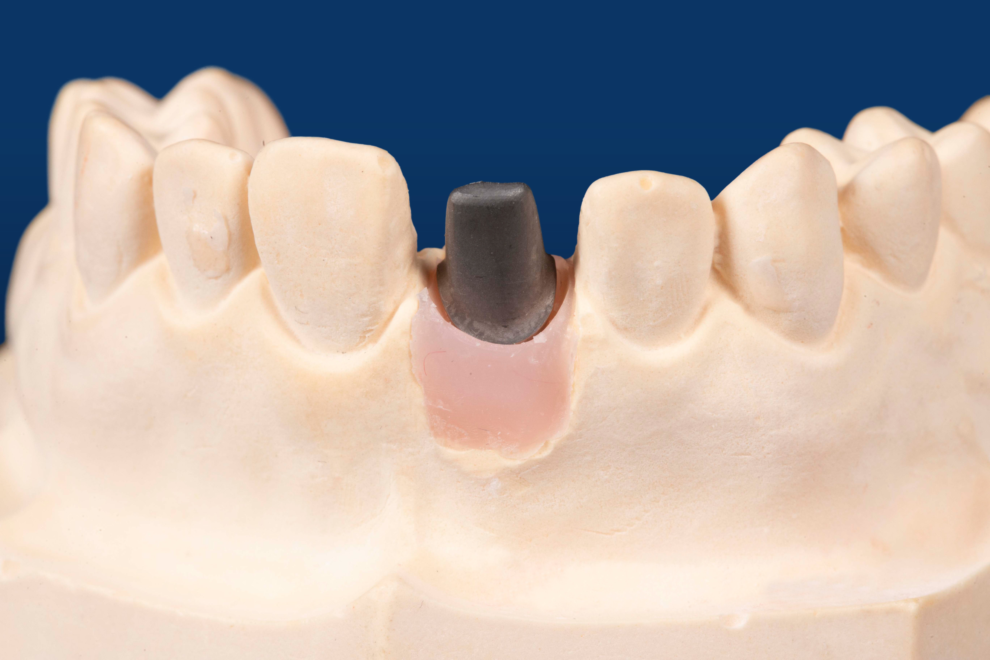 Sandblasted Titanium Custom Abutment Rectangular Implant Custom Abutment