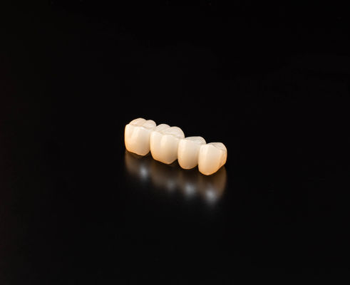 Crown & Bridge manufacturer from China