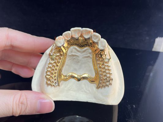 الصين chrome partial denture framework design مصنع